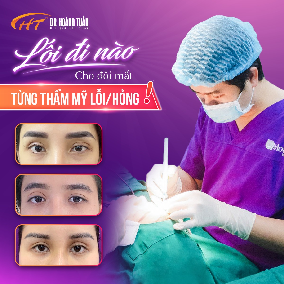 Lối đi nào cho đôi mắt từng cắt mí hỏng?